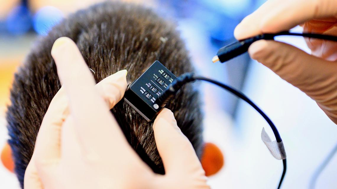 Experimental brain-computer implant helps stroke survivor speak again ...