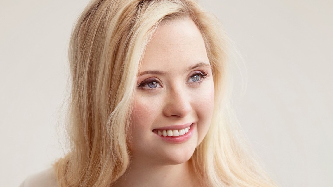 St. Louis woman with down Syndrome models for skincare line Obagi ...