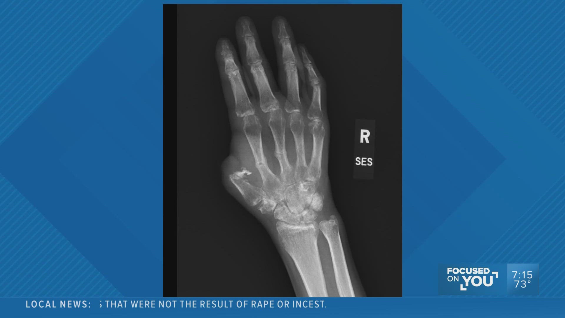 How you can keep your family safe around fireworks this Fourth of July ...