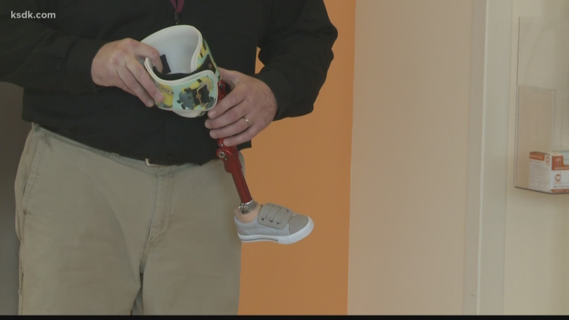 3-year-old boy gets new prosthetic leg after his was stolen | ksdk.com