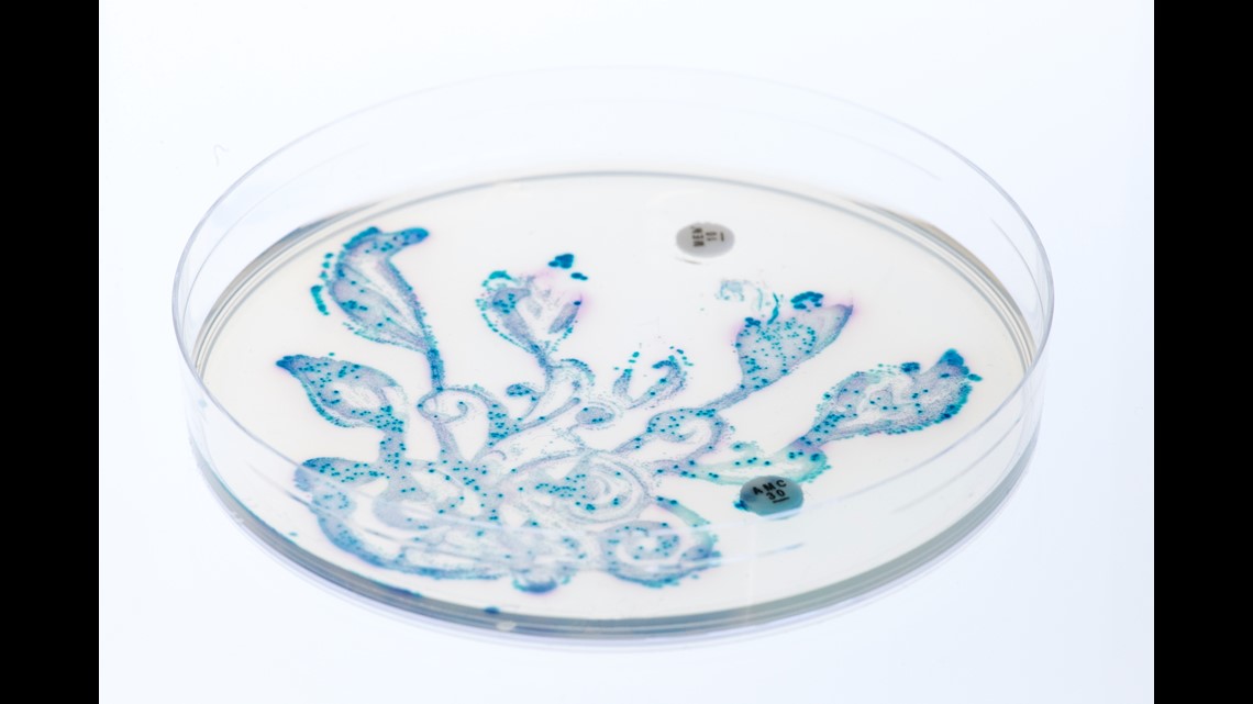 Scientists find clues on health and disease in poop samples | ksdk.com