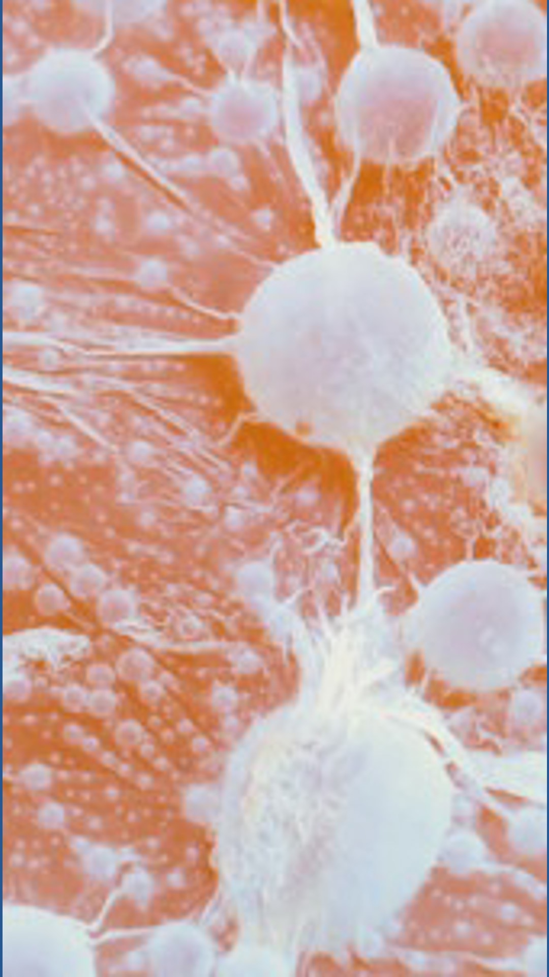 American Cancer Society approves new at-home HPV test | ksdk.com
