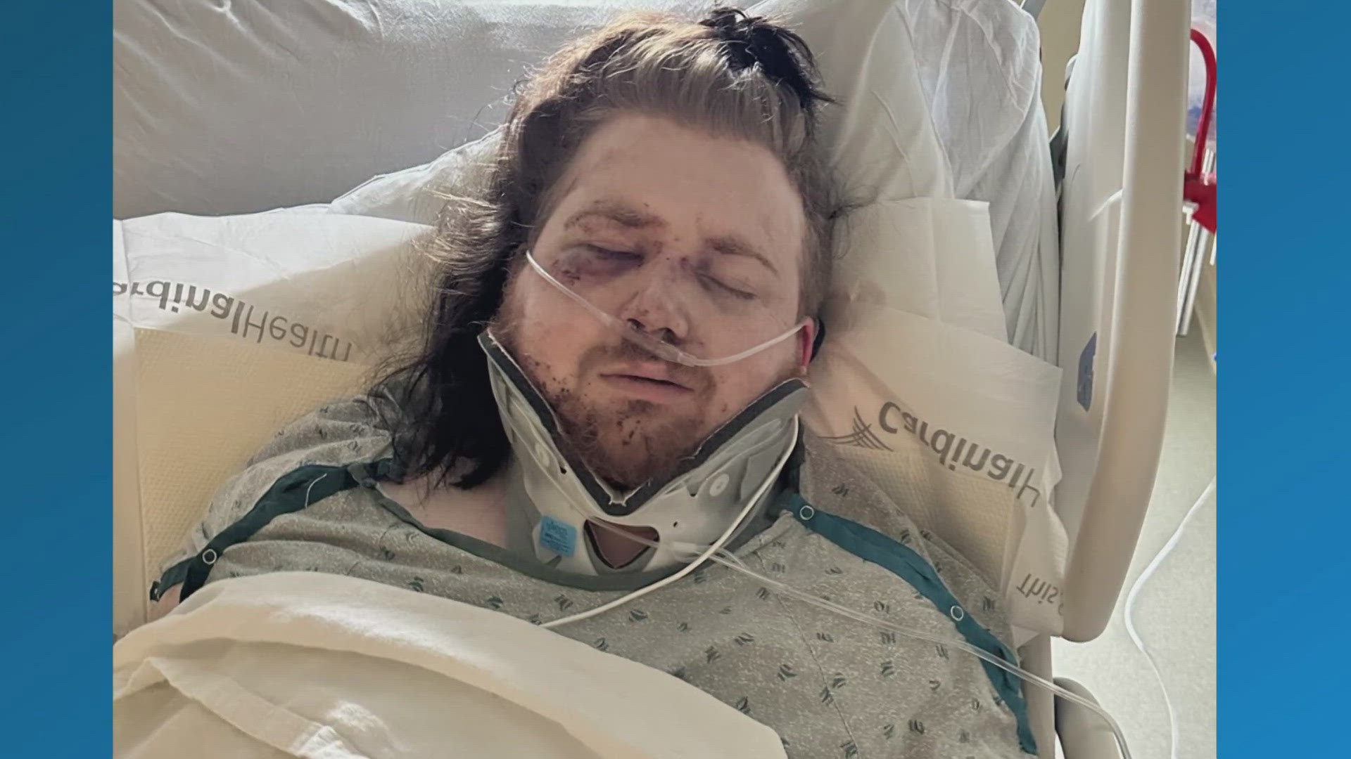 Hate crime charge added after neighbor severely beat CNA; brother: 'he ...