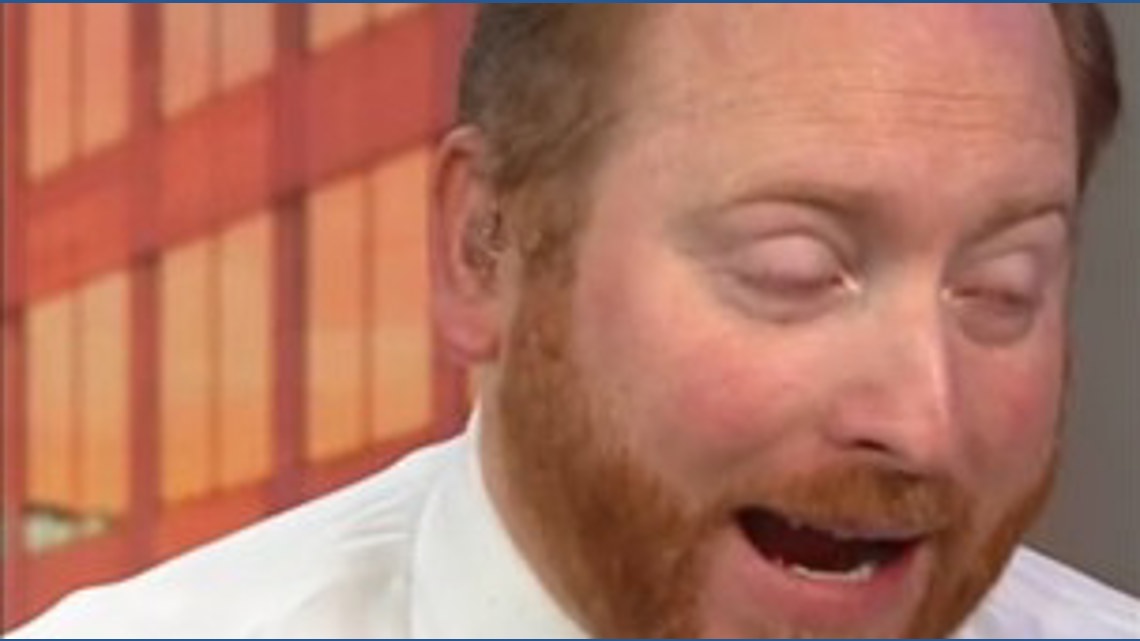 St. Louis police hunts 'monkey sighting' officer | ksdk.com