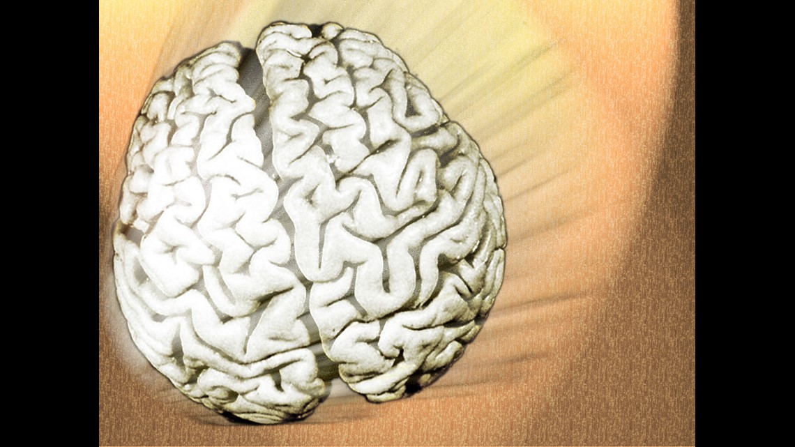 Some lost memories could be restored | ksdk.com