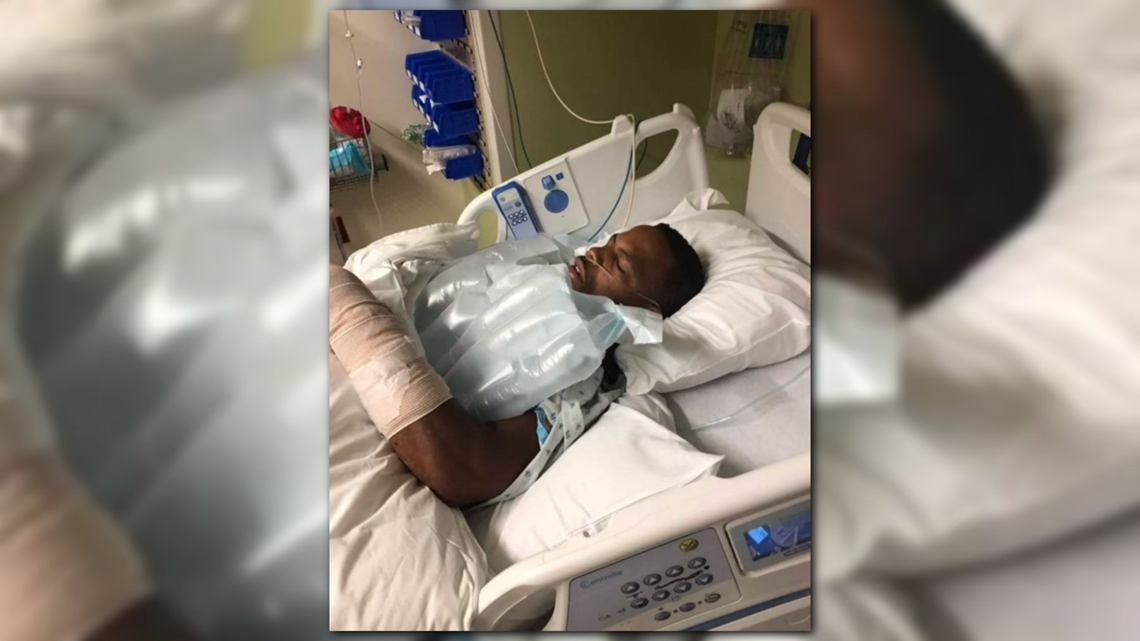 Firework explodes in man's hand during Fourth of July celebration ...