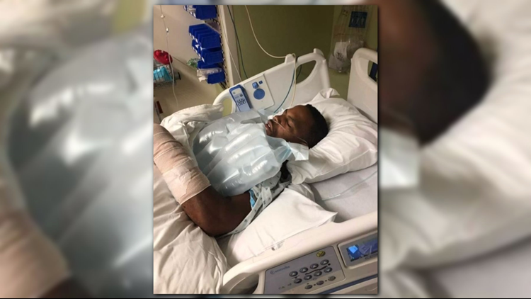 Firework explodes in man's hand during Fourth of July celebration ...