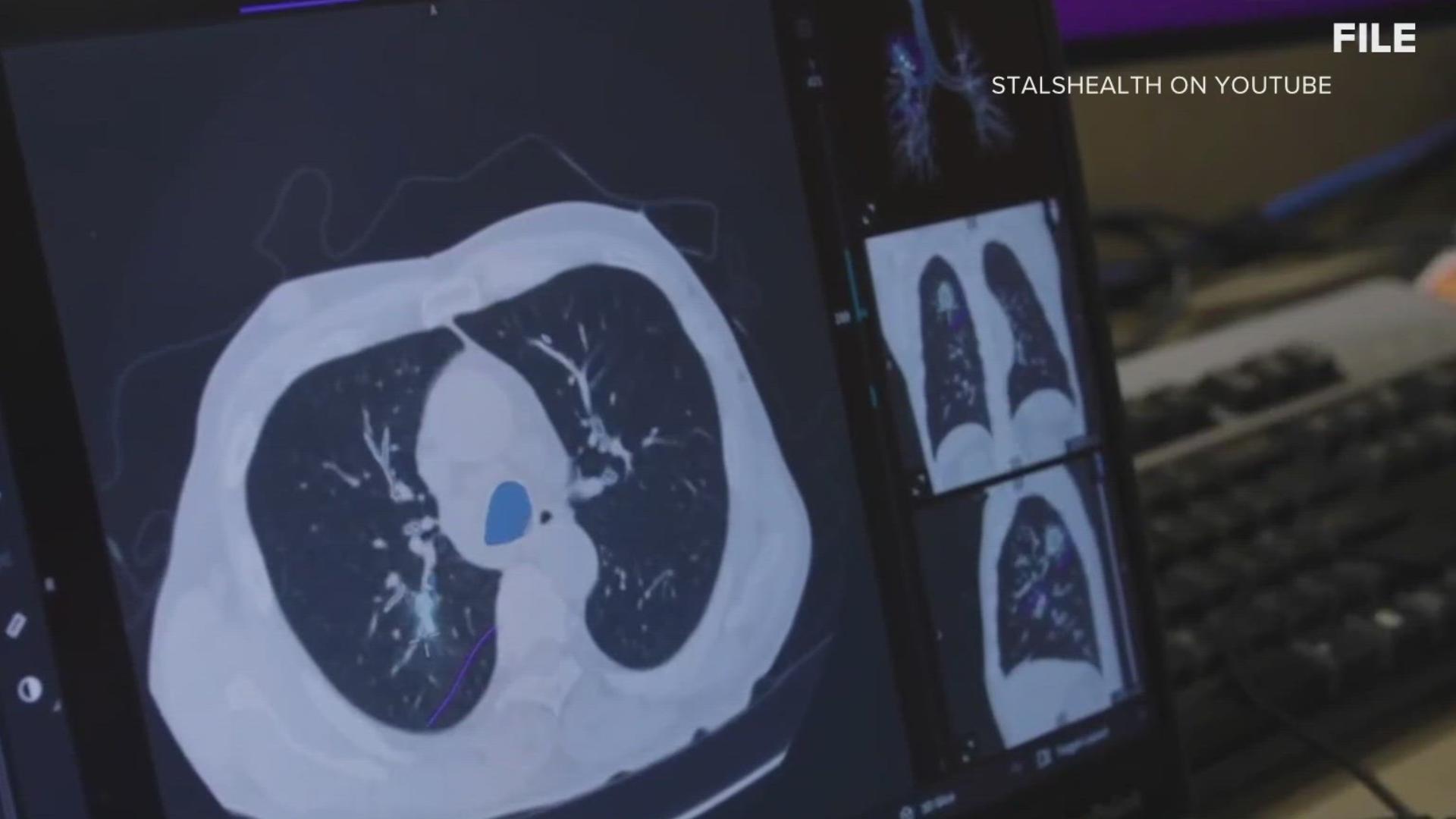 'It's a very complicated topic': Does where you live raise your risk of ...