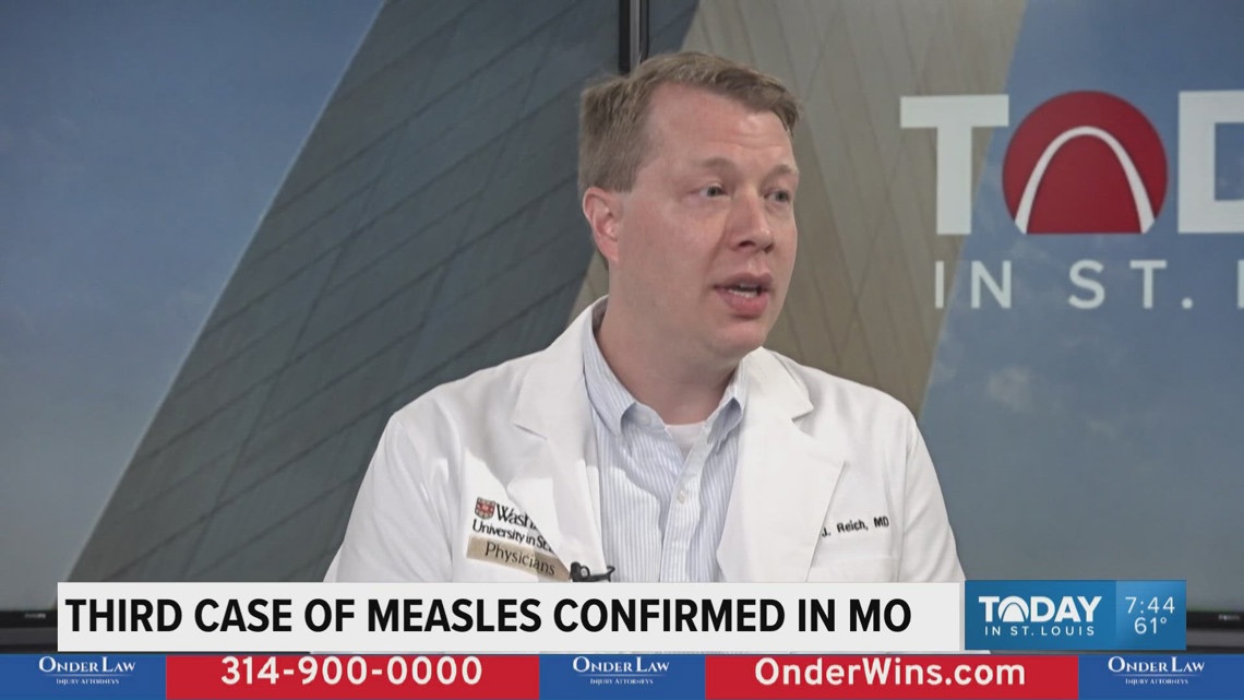 WashU pediatric disease expert answers your measles questions | ksdk.com