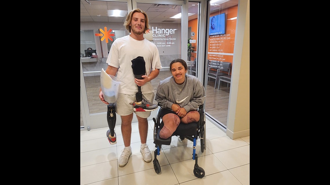 Volleyball player who lost legs in crash gets prosthetics | ksdk.com