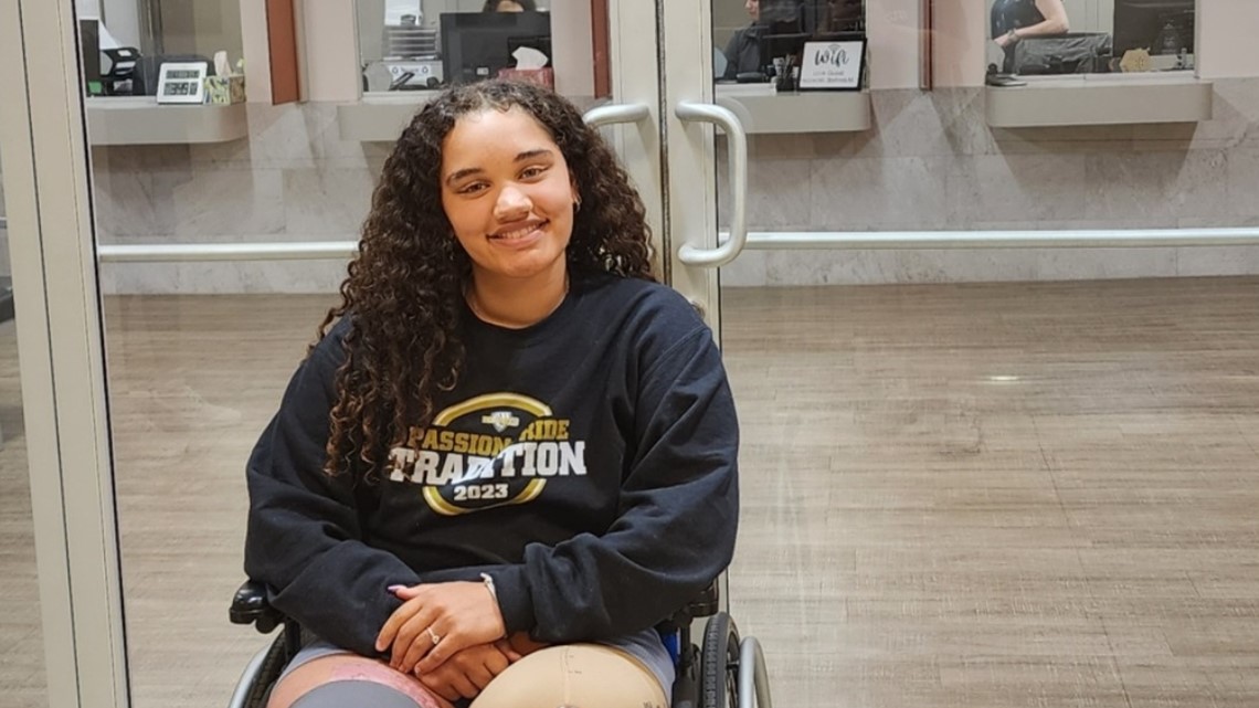 Volleyball player who lost legs in crash gets prosthetics | ksdk.com