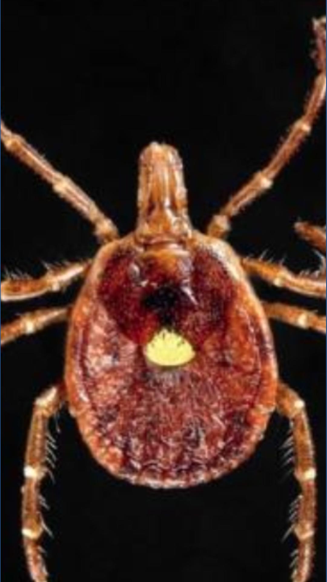 No, Bill Gates didn't create the tick-borne red meat allergy, despite ...