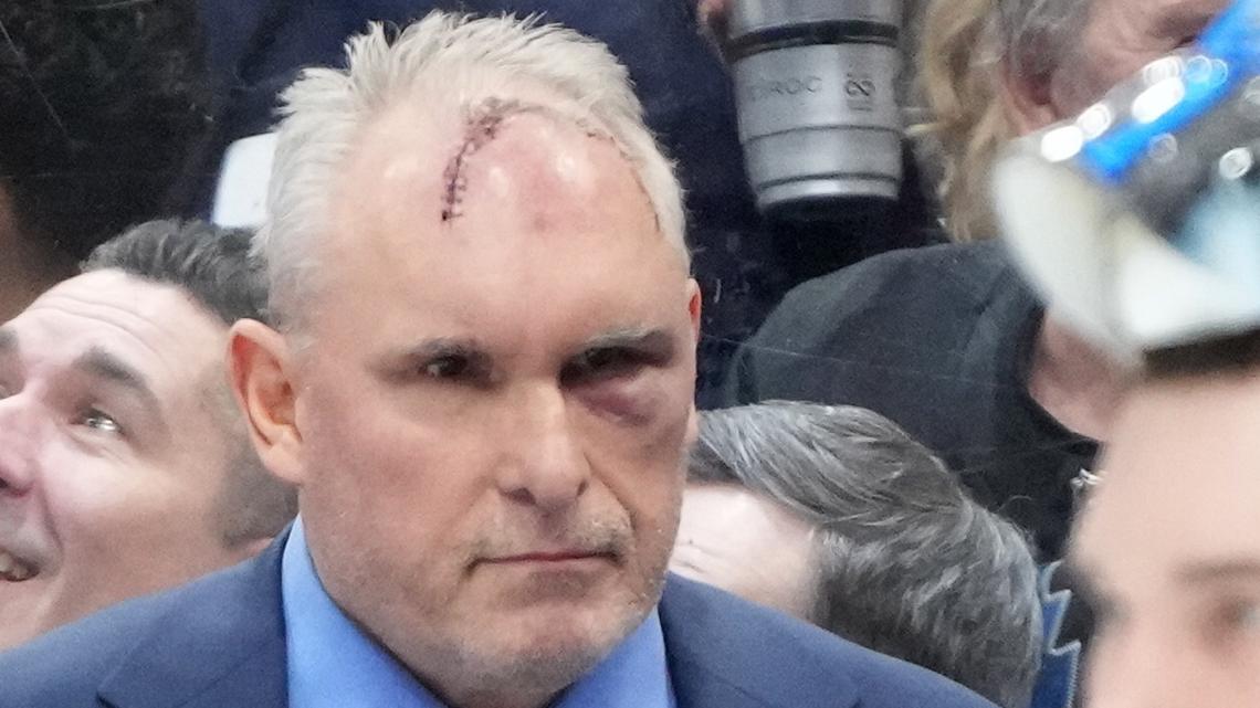 Former Blues coach Craig Berube sports gruesome head injury from gym ...