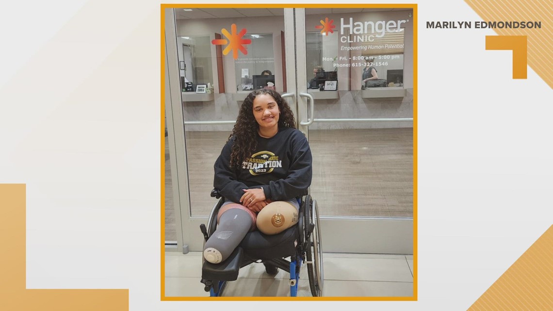 5 months after losing her legs in downtown crash, Janae Edmondson will ...