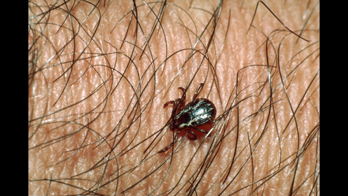 Should I burn a tick off? 5 common myths about ticks | ksdk.com