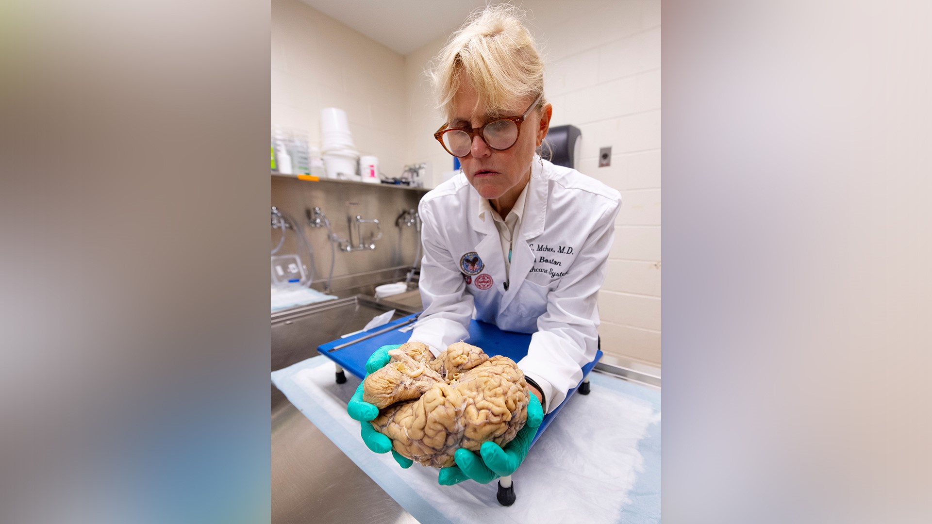 Researchers close in on CTE diagnosis in living, one brain at a time ...