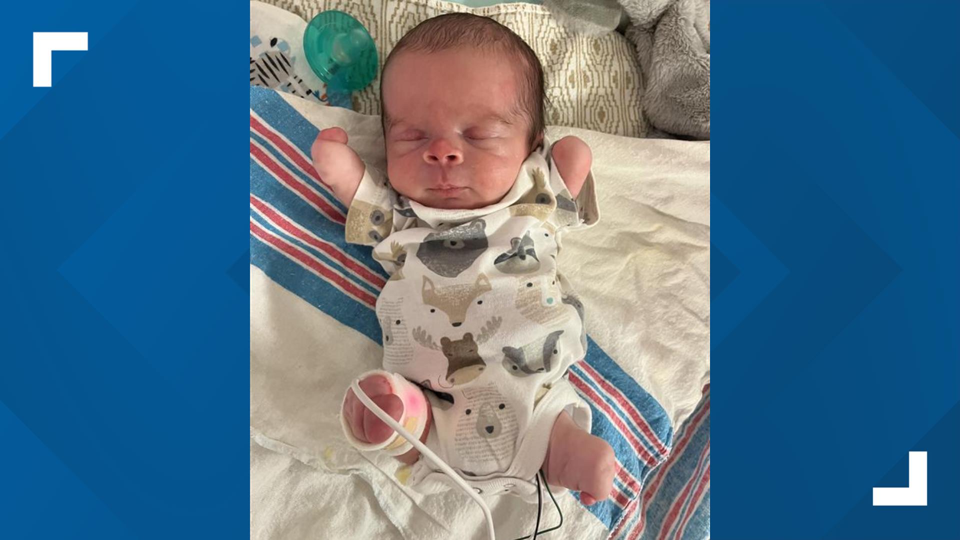 North Carolina baby born without arms or legs is defying the odds ...